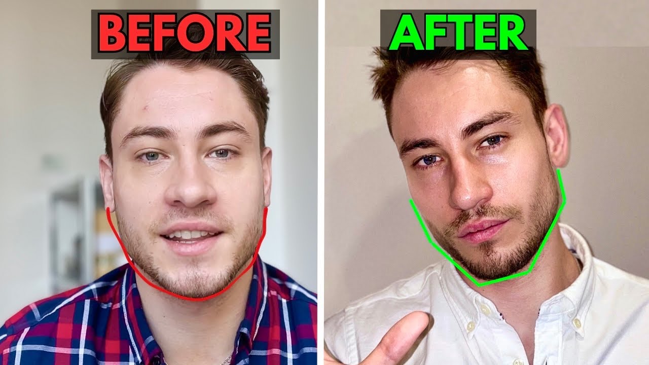 The 5 Best Mewing Exercises Advanced Daily Routine Youtube