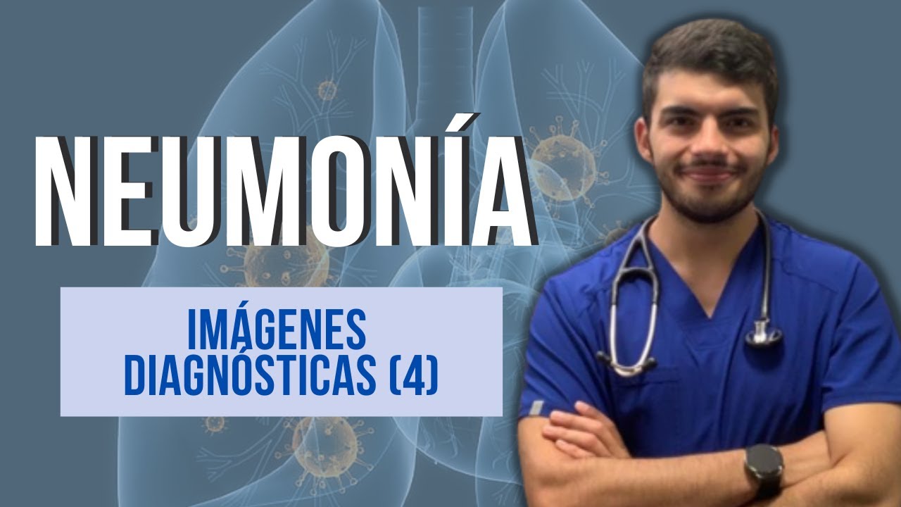 Neumonía Imágenes Diagnósticas Parte 4 Youtube