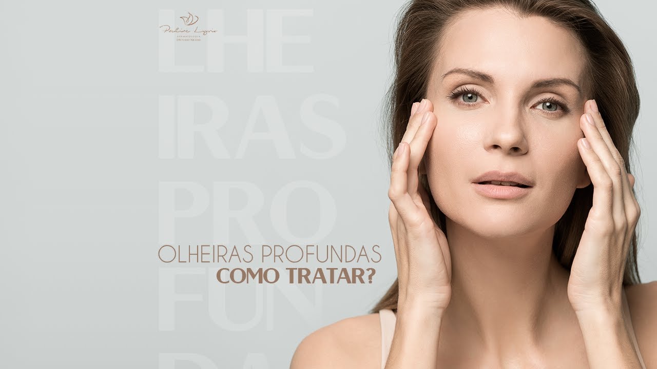 Como Tratar As Olheiras Profundas Em Vitória Es