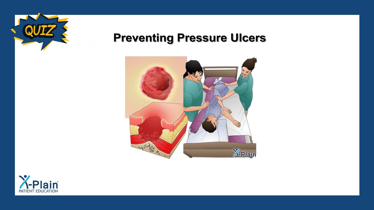Preventing Pressure Ulcers Quiz Youtube