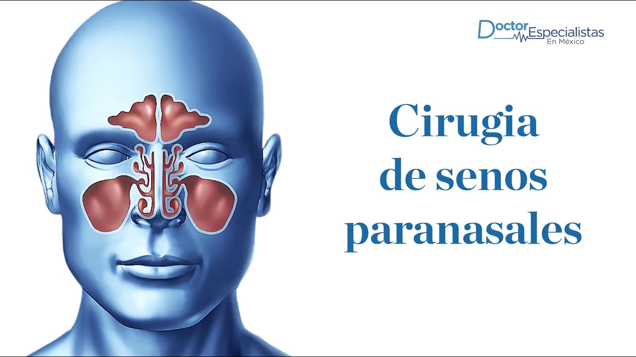 Cirugia De Senos Paranasales Doctor Especialistas Mexico Youtube