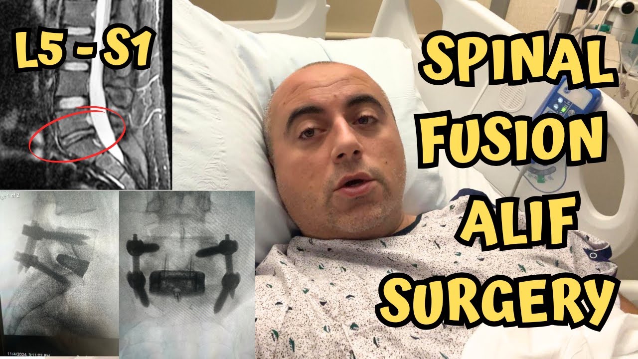 My Hospital Stay For L5 S1 Spinal Fusion Surgery Alif Youtube