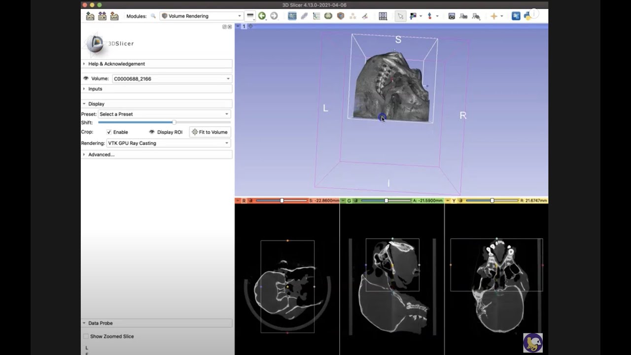 Cropping A Volume 3d Slicer Workflow Youtube