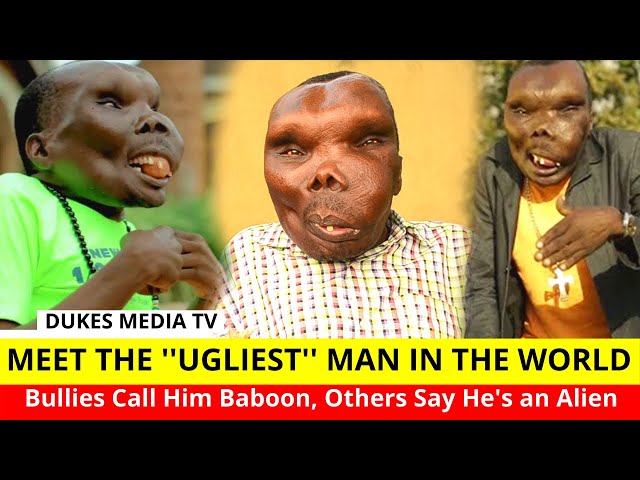 Meet Sebabi The Ugliest Man In The World Born Different 52250c