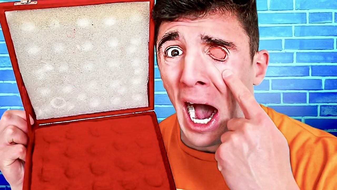 I Got Robbed Youtube