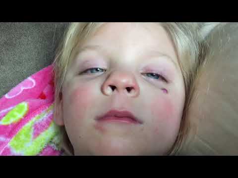 Passed out girl feet and eye check (bonus snoring) - VidoEmo ...