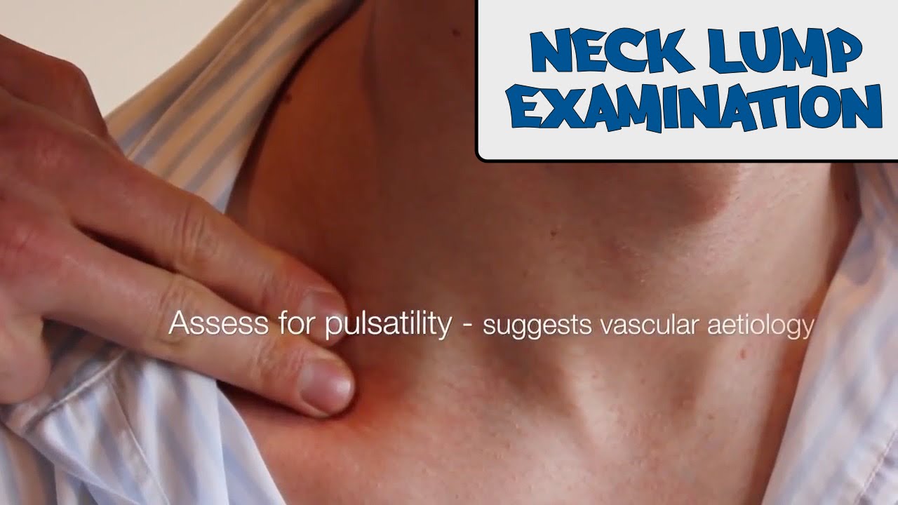 Cancerous Cyst On Neck