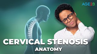 Simple Cervical Spinal Stenosis Exercises Plus Symptoms 45 Off