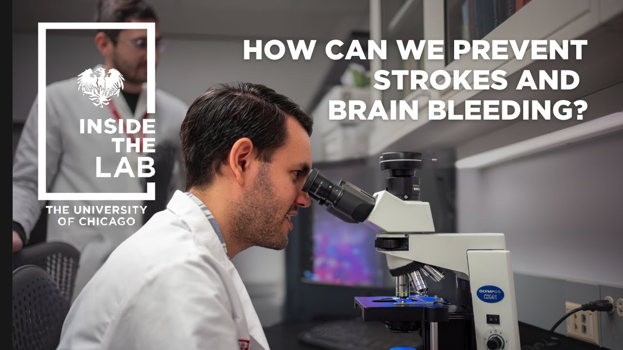 Awad Lab Predicting And Preventing Strokes And Brain Bleeds Inside