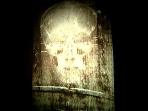 Dr Alan Whanger S Technique Possible Image Formation Youtube