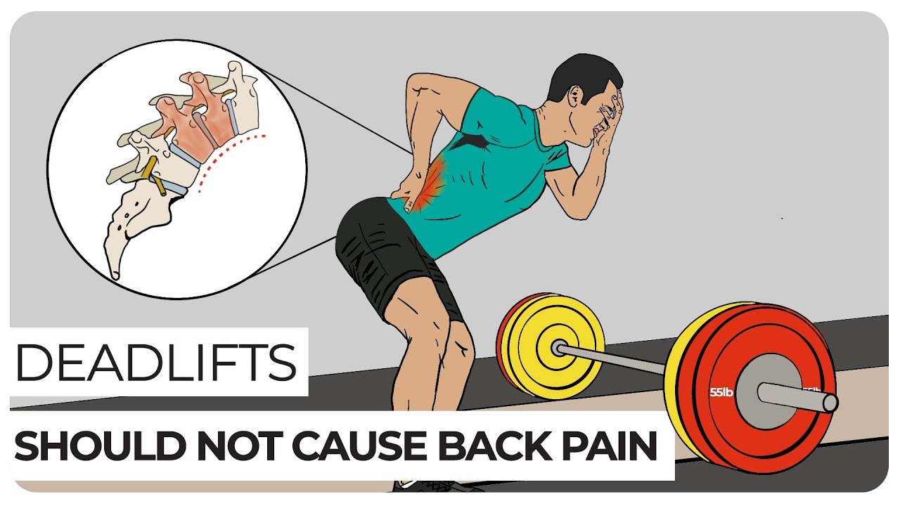 The Cause Of Lower Back Pain After Deadlifts Youtube