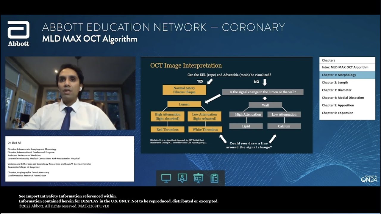 Oct Image Interpretation Youtube