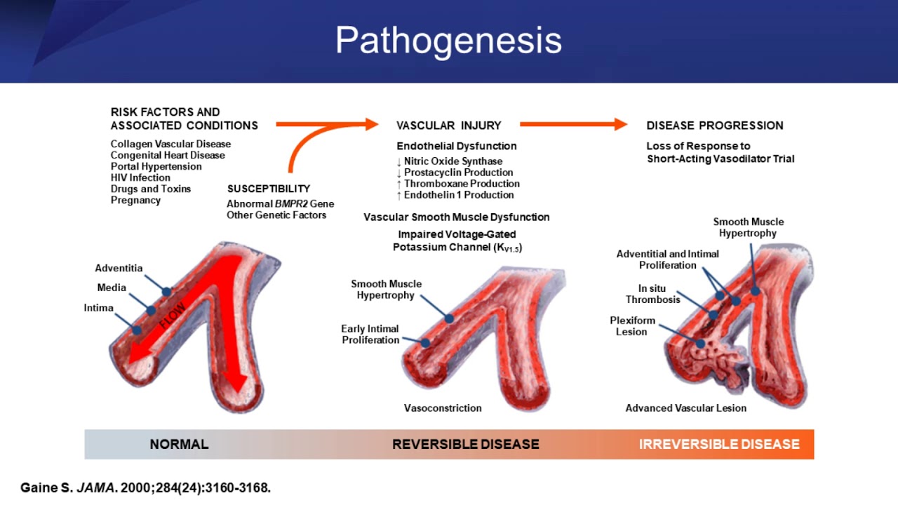 Arterial Hypertension