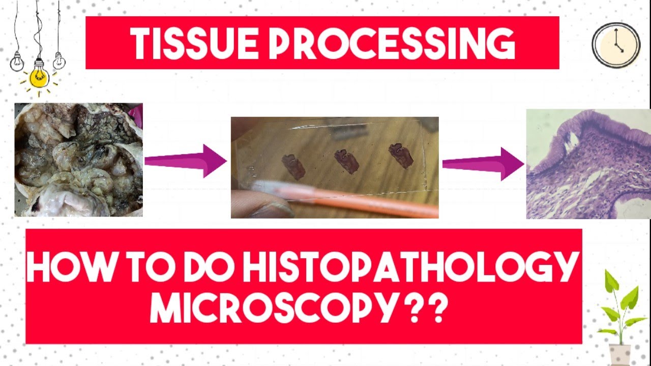 Tissue Processing How To Do Histopathology Light Microscopy 9