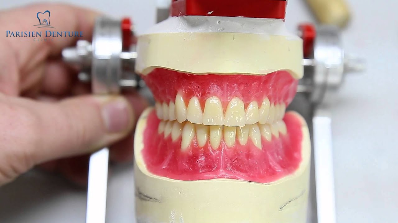 What Materials Are Dentures Made From At Manuela Frasher Blog