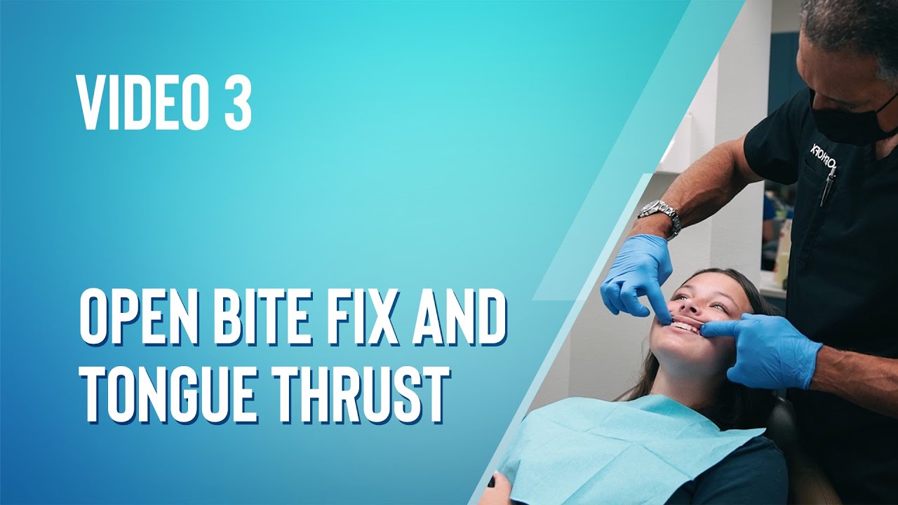 How To Fix A Tongue Thrust Ways To Tell If You Have Tongue Thrust And