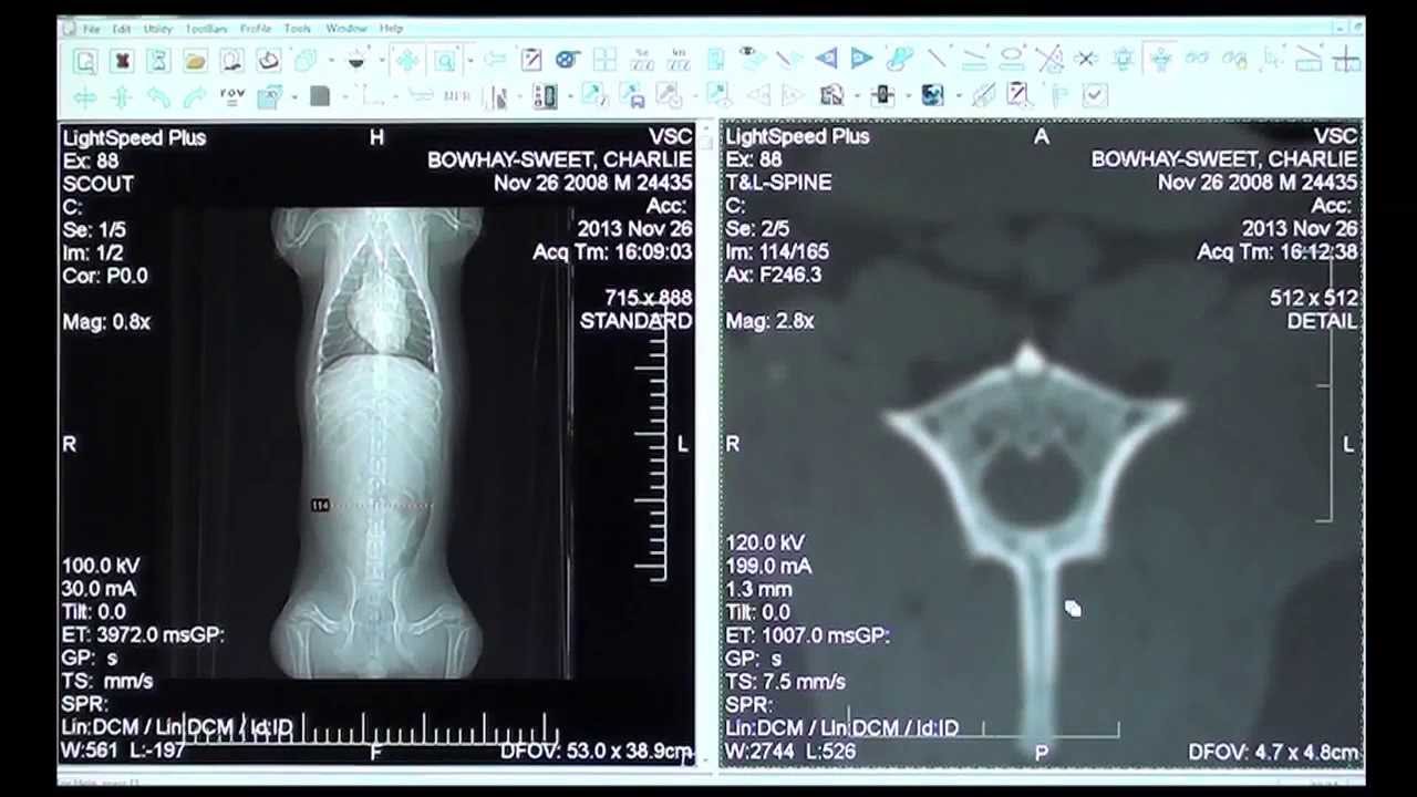 Ct Demo Youtube