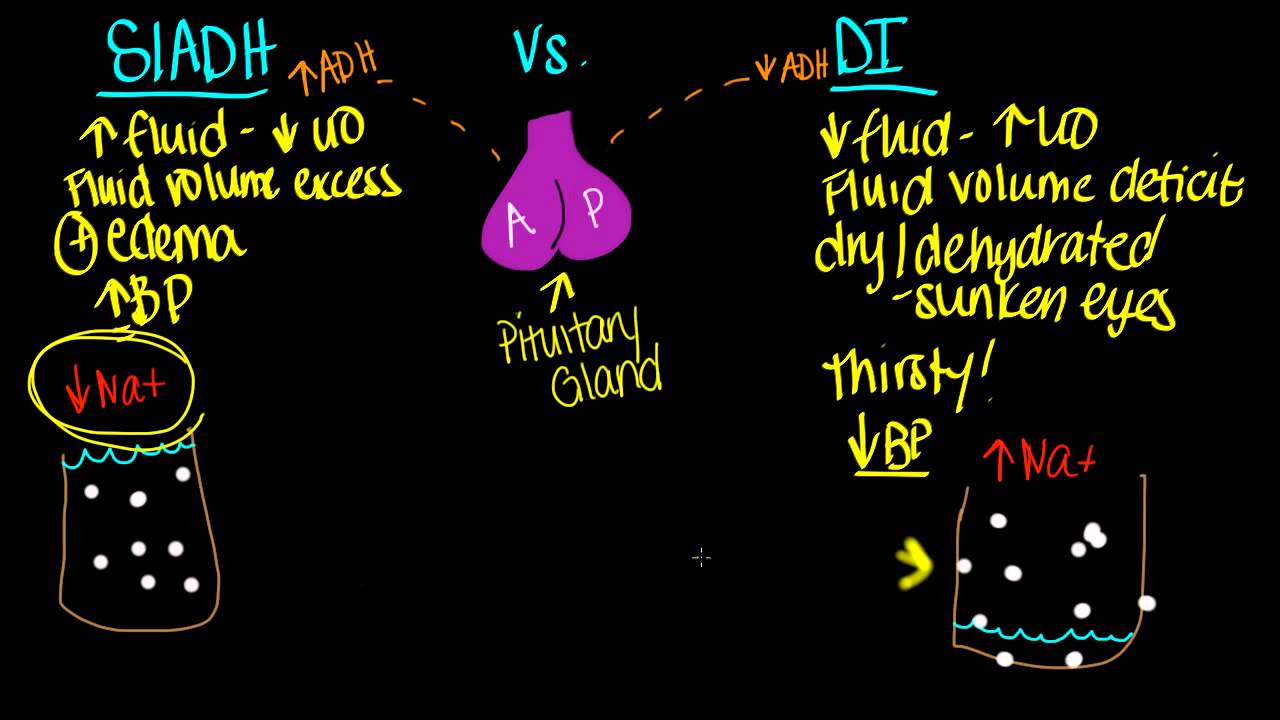 Siadh Vs Di Youtube