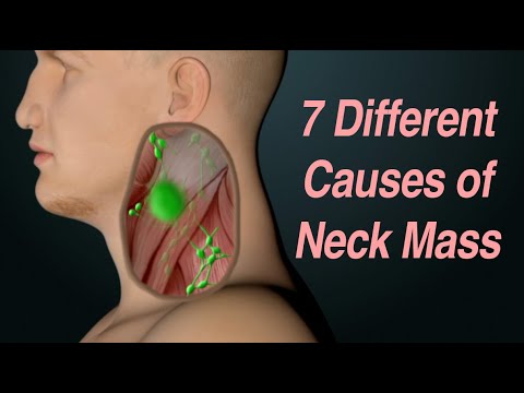 A Sore Spot In My Front Throat And Neck