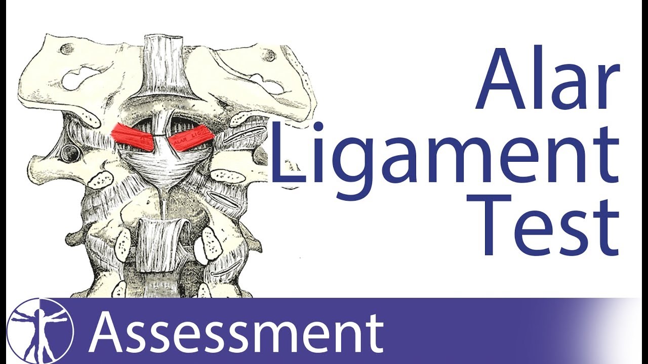 Alar Ligament Stress Test Upper Cervical Spine Instability Youtube