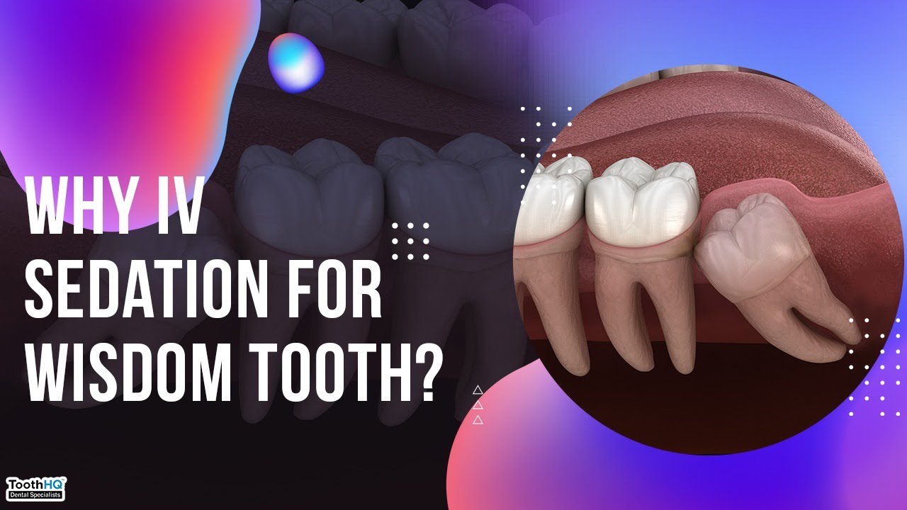 Why Iv Sedation For Wisdom Tooth Youtube