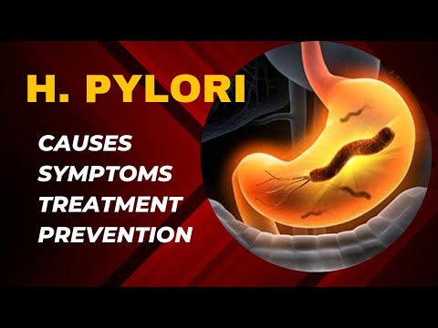 ёяжа H Pylori Causes Symptoms Treatment And Prevention Youtube