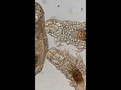 Tardгќgrados Canгќbales Bajo El Microscopio рџ Youtube