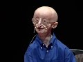 My Philosophy For A Happy Life Sam Berns Tedxmidatlantic Tedx Talks Mp3 ...