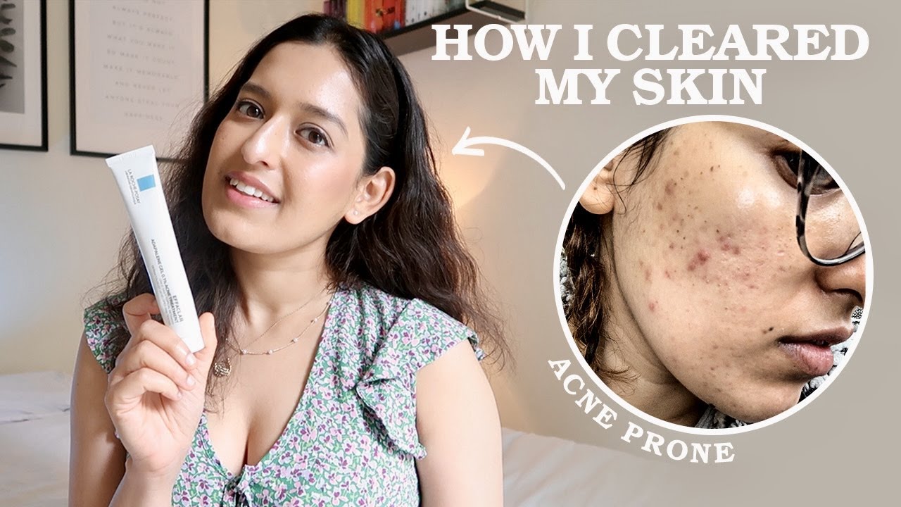 My 3 Step Evidence Based Skincare Routine As A Doctor How I Cleared