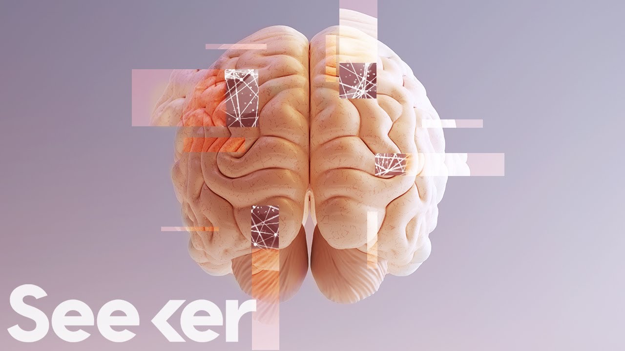 How Close Are We To A Complete Map Of The Human Brain Youtube