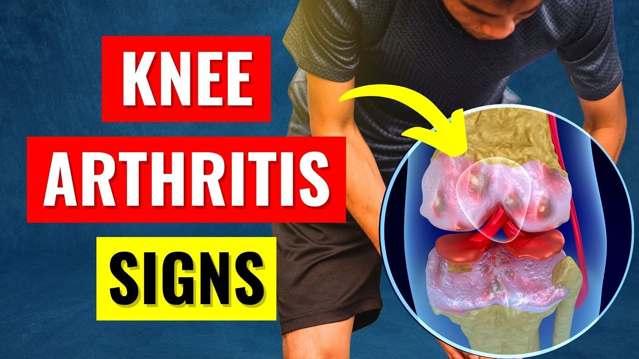 Top 7 Signs Symptoms You Have Knee Arthritis