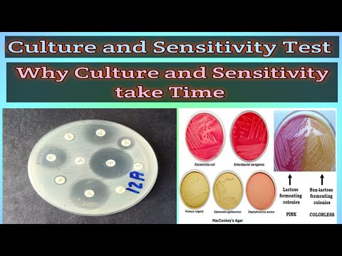 Culture And Sensitivity Test For Urine Blood Swab Pus It S Exact