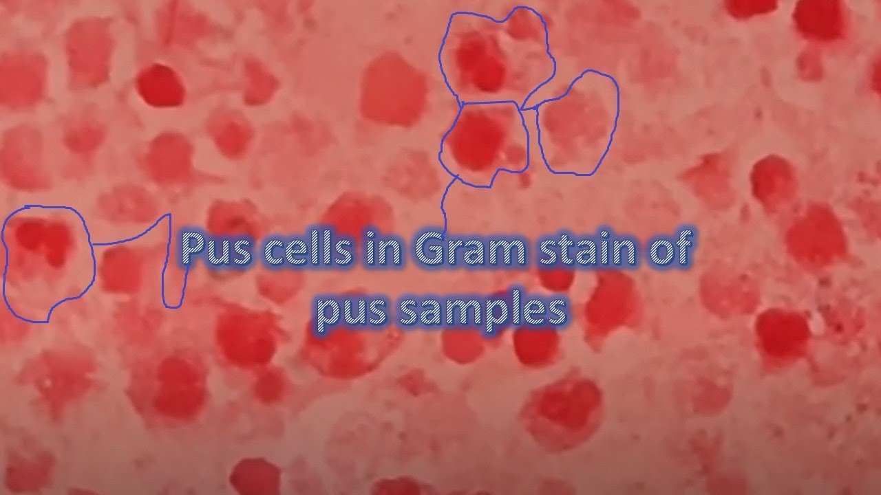 Pus Microscope