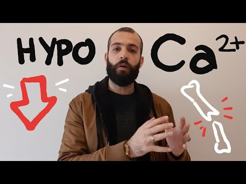 How To Deal With Hypocalcemia Reda Md Youtube