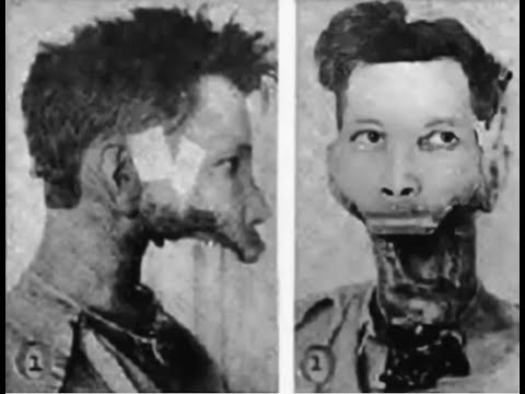 The Scary Story Of Eben Byers The Man Who Drank Radium Until His Jaw