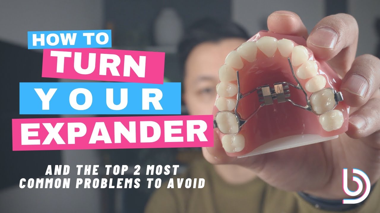 How To Turn An Expander For Braces At Benjamin Macbain Blog