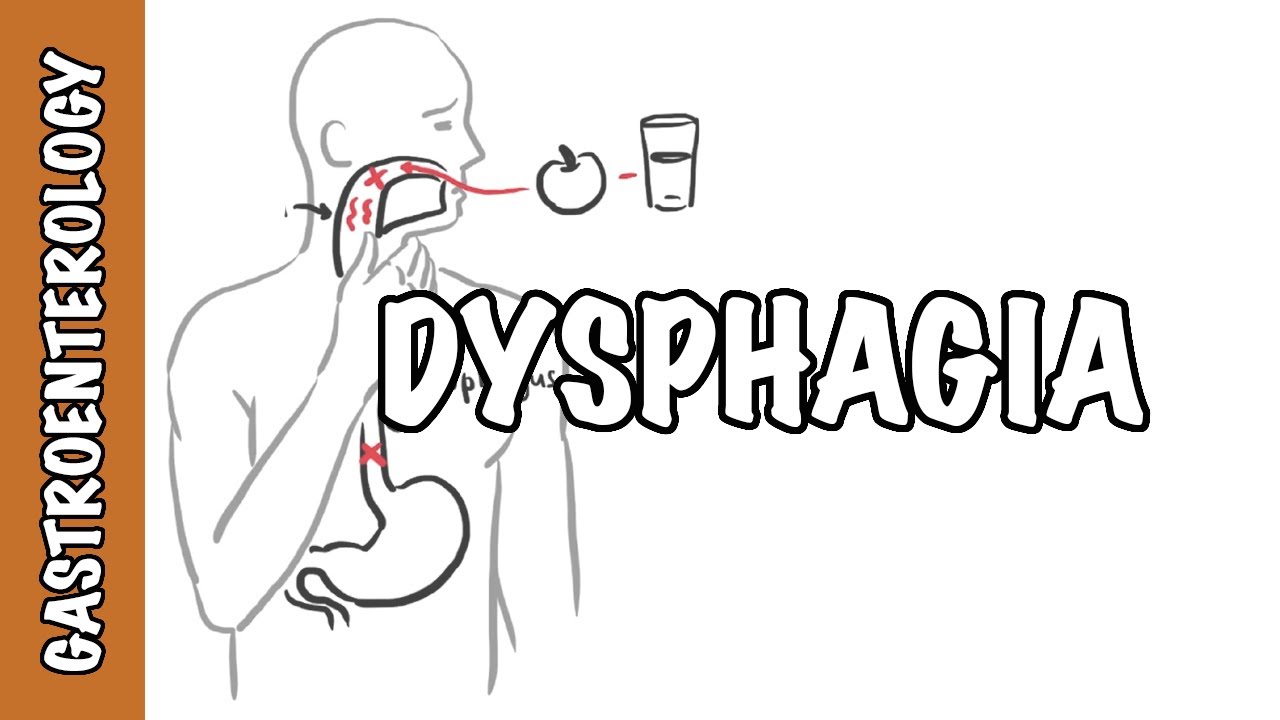 Dysphagia Swallowing Difficulty Types Symptoms Causes