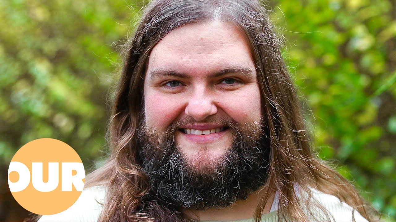 Bearded Woman Lives Without Any Regrets Born Different Our Life