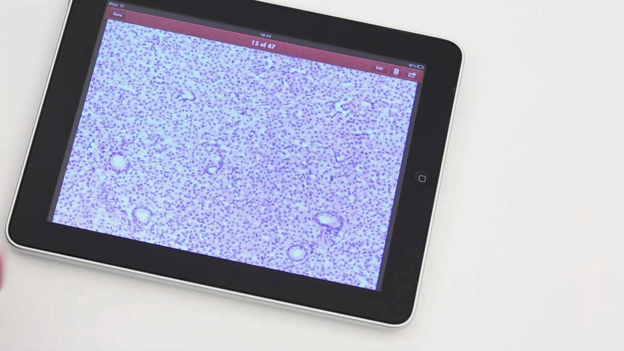 Microscope Ipad At Melissa Knop Blog
