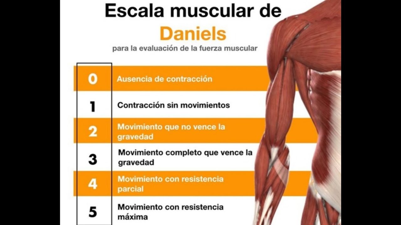Valoración Muscular Basada En Escala De Daniels Miembros Superiores E