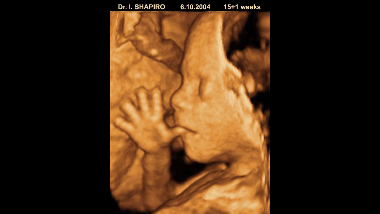 3d Ultrasound Pictures 3d Ultrasound Pregnancy 3d Puzzle Image To