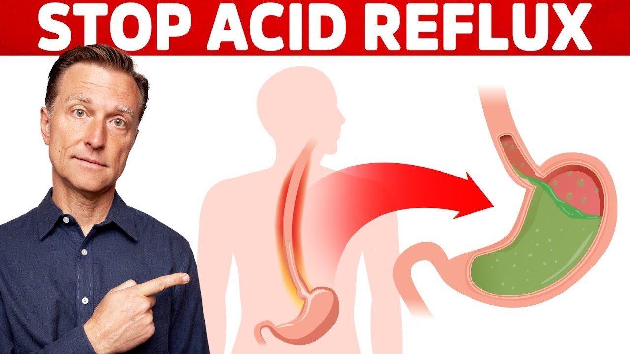 How To Stop Acid Reflux Instantly Youtube