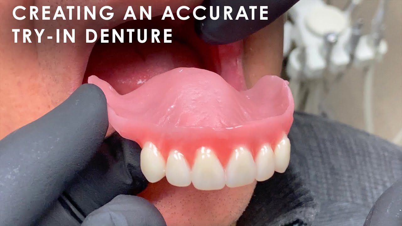 Creating An Accurate Try In Denture Youtube