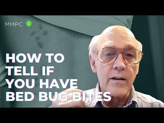 6 Things How To Tell If You Have Bed Bug Bites An Entomologist Explains