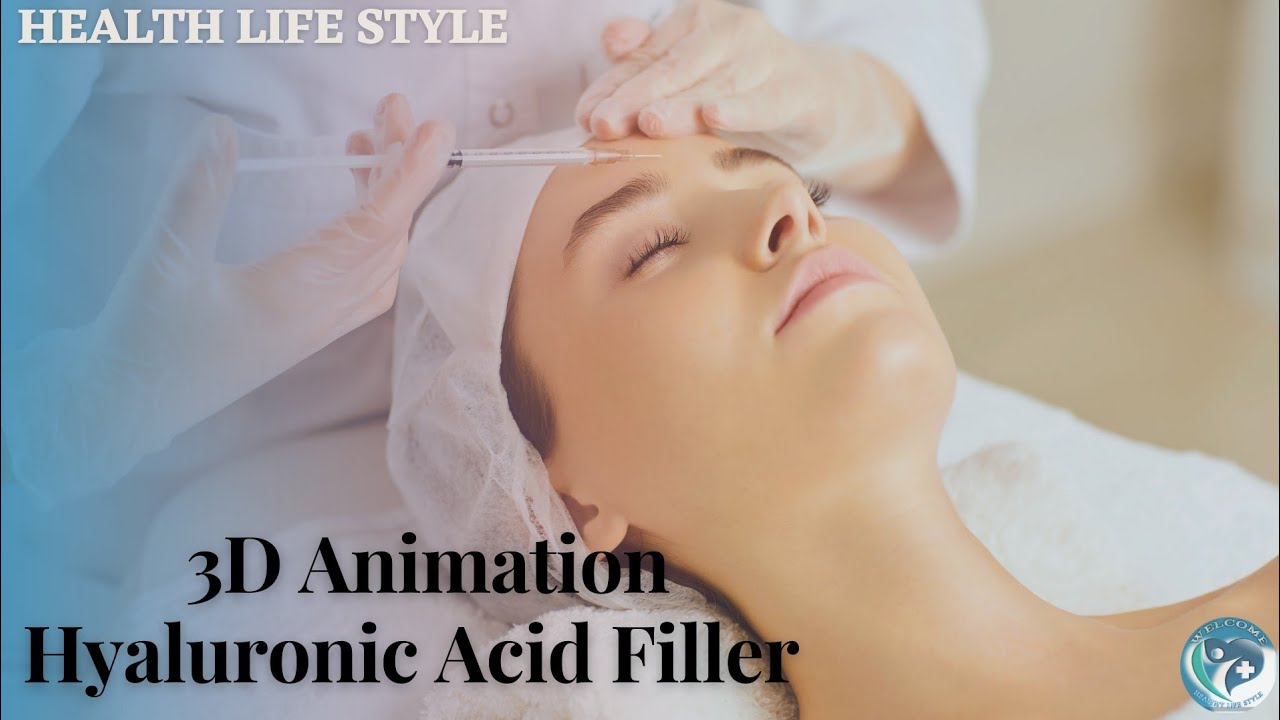 3d Animation Hyaluronic Acid Filler Hyaluronic Acid Injection