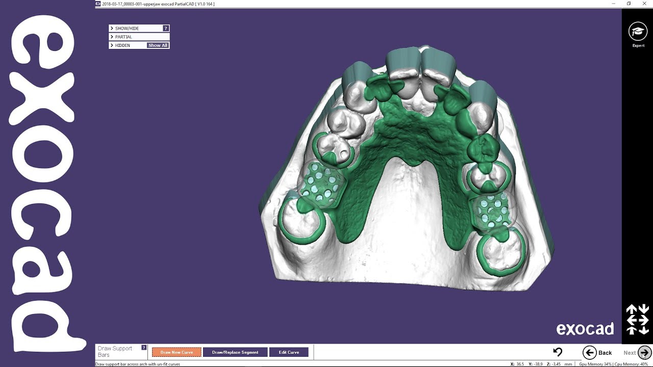 Exocad Video Tutorial Basic Designing A Removable Partial Framework