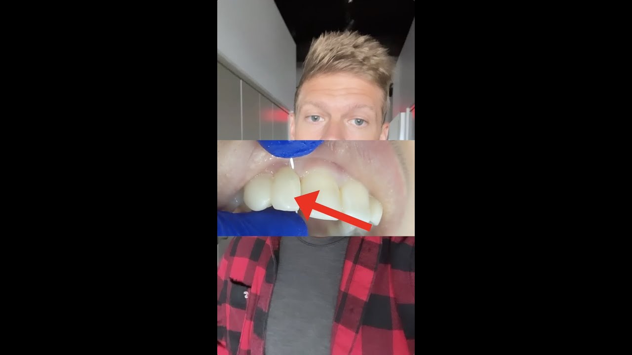 Crazy Flossing Trick Explained рџ Shorts Youtube