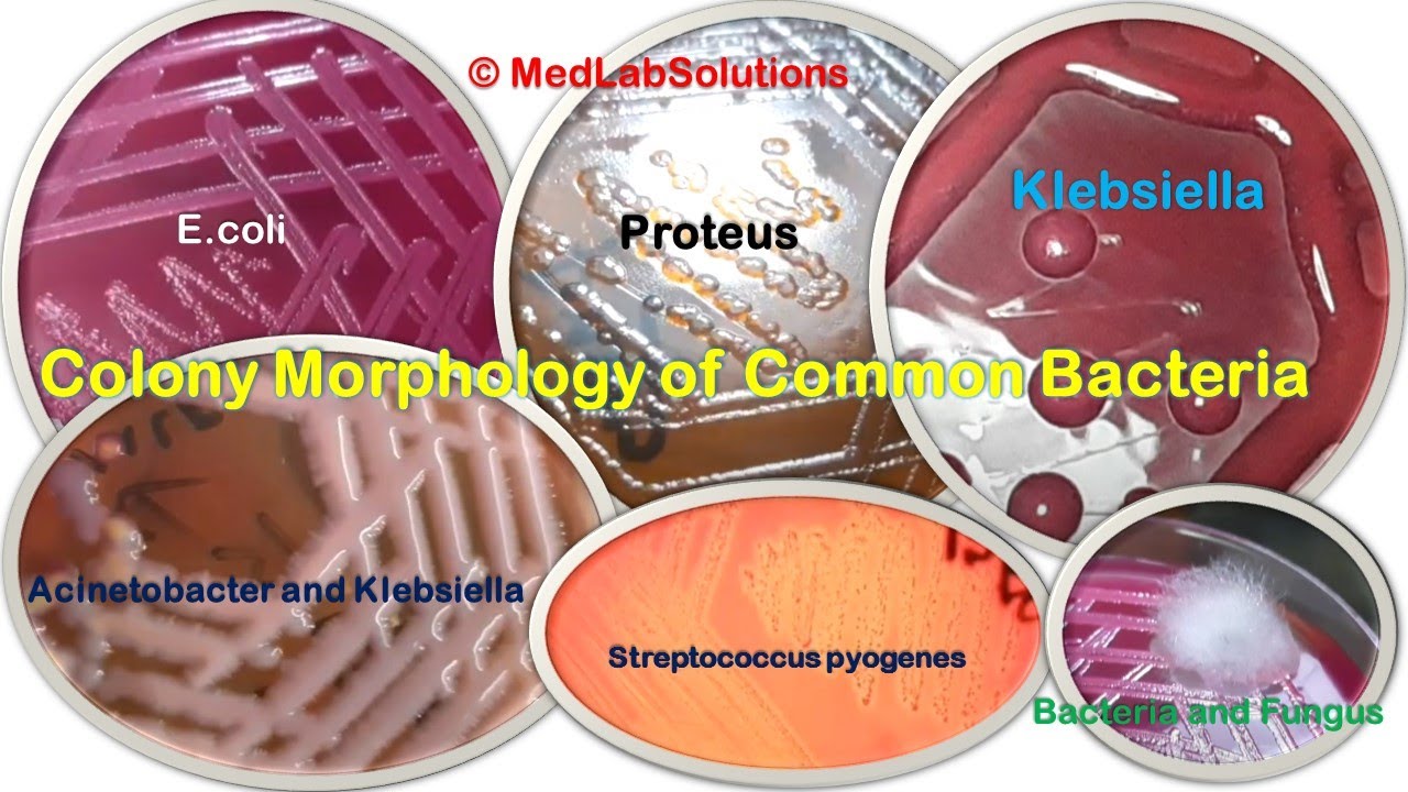 Colony Morphology Of Bacteria