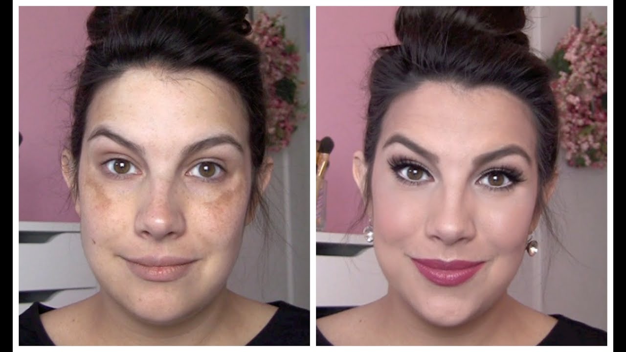 Melasma Cover Up Makeup Uk Mugeek Vidalondon