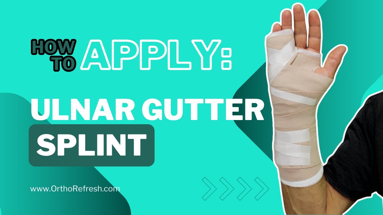 How To Apply An Ulnar Gutter Splint For A Broken Hand Boxer S